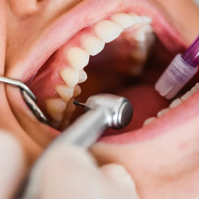 Activador de Klammt: qué es y cuál es su función