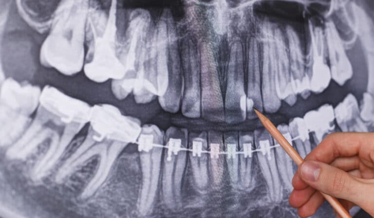 ¿Qué es Rhodogil, para qué sirve y cuándo está indicado?